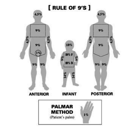 Brûlures cutanées - Astuces Pharma