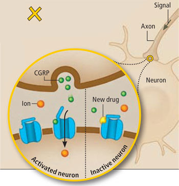 Médicaments de la migraine - Astuces Pharma